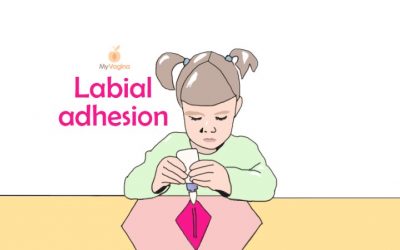 Details to Know about Labial Adhesion in A Baby – Platform | CME