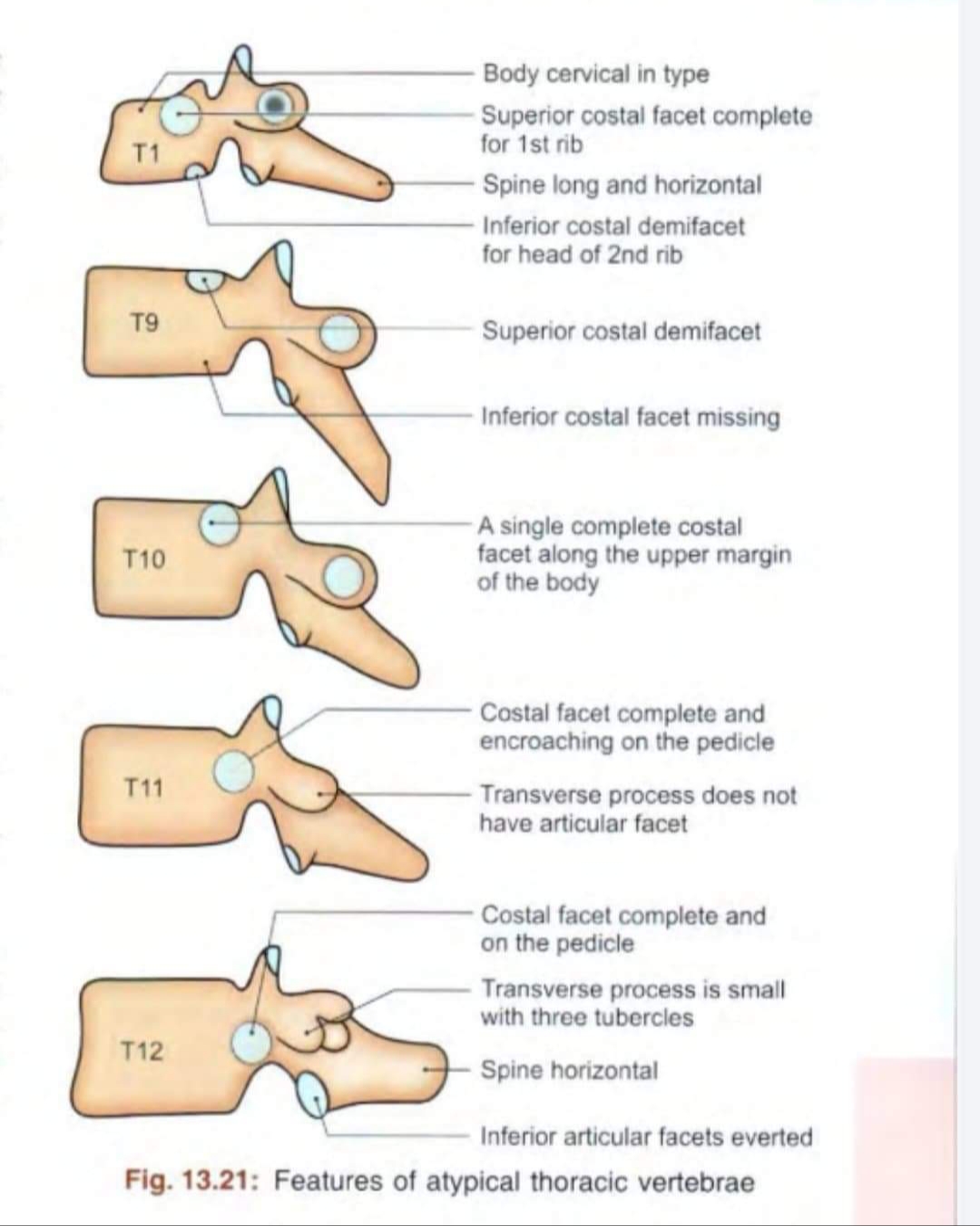 Discussion on Thoracic Vertebrae (Part-02) – Platform | CME