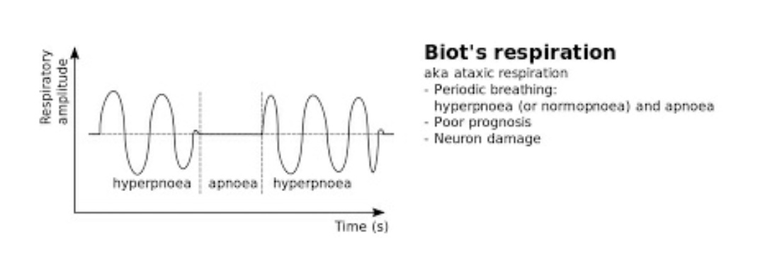 A thorough Discussion about Abnormal Breathing pattern – Platform | CME