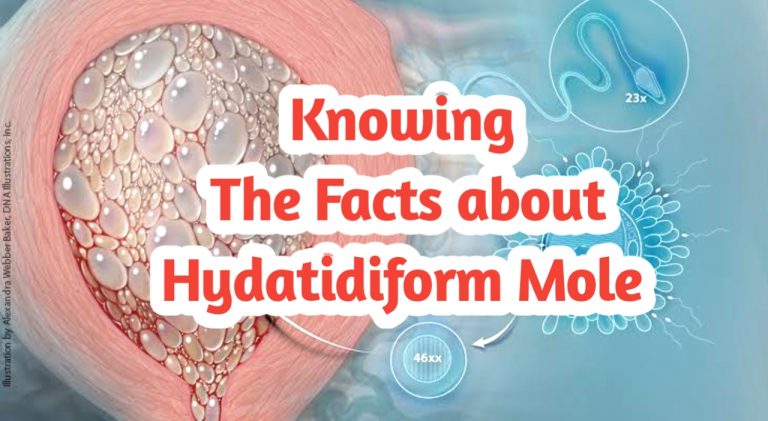 Knowing The Facts about Hydatidiform Mole – Platform | CME