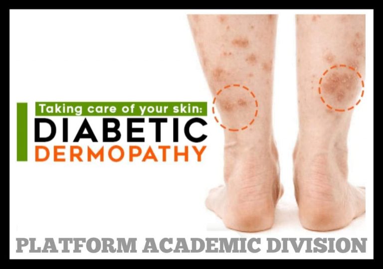 ”Diabetic shin spots/ Diabetic Dermopathy” – Platform | CME