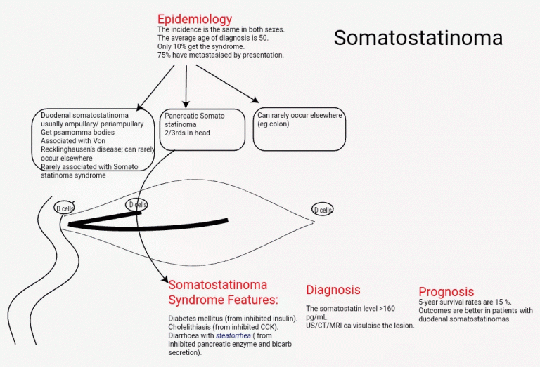 A Discussion About Somatostatinoma – Platform | CME
