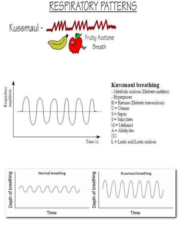 Abnormal respiratory pattern: Kussmauls Breathing – Platform | CME
