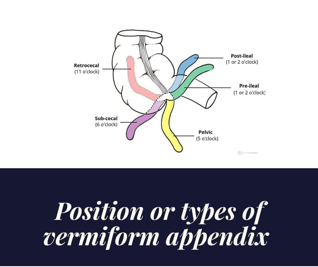 গল্পে গল্পে Large Intestine – Platform | CME