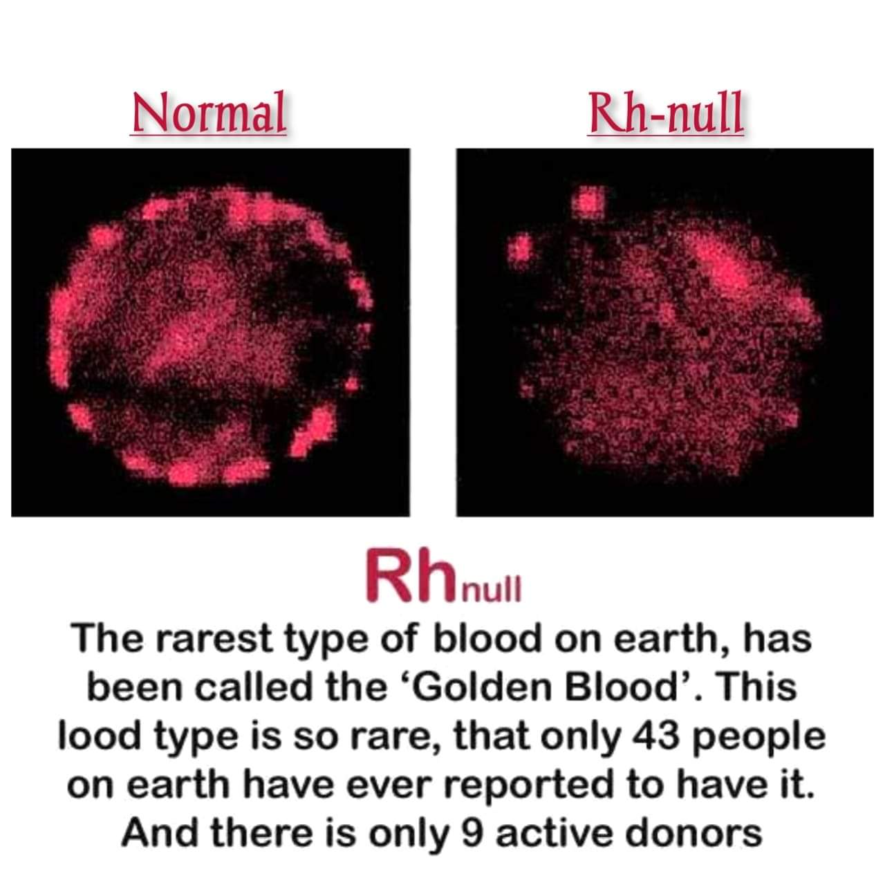 Man with the “Golden Blood” – Platform | CME